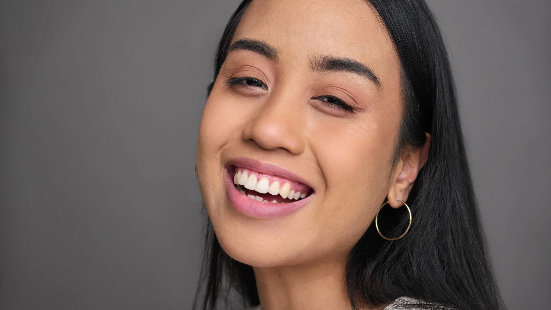 IPL PhotoFacial In Seattle, WA | Seattle Face & Skin